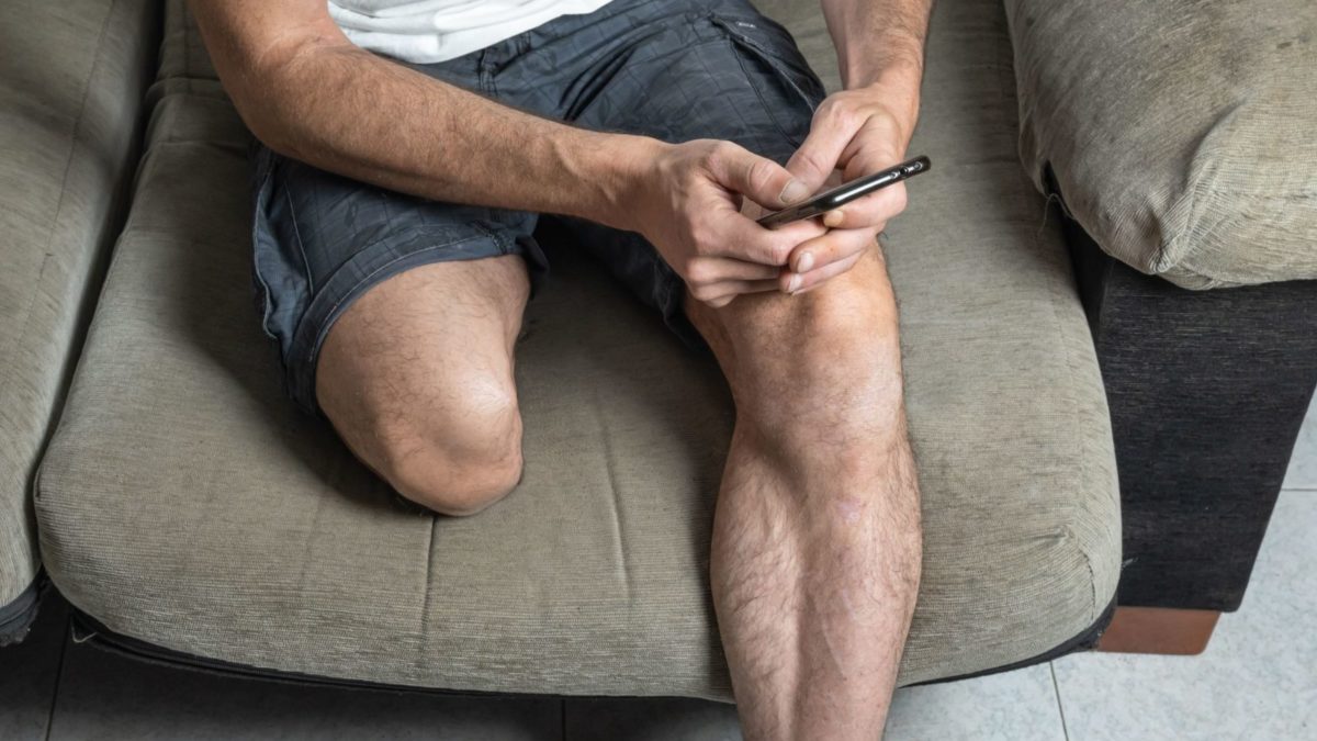 „Amputation Was nun?“ – Neue App von Betroffenen für Betroffene • pt ...